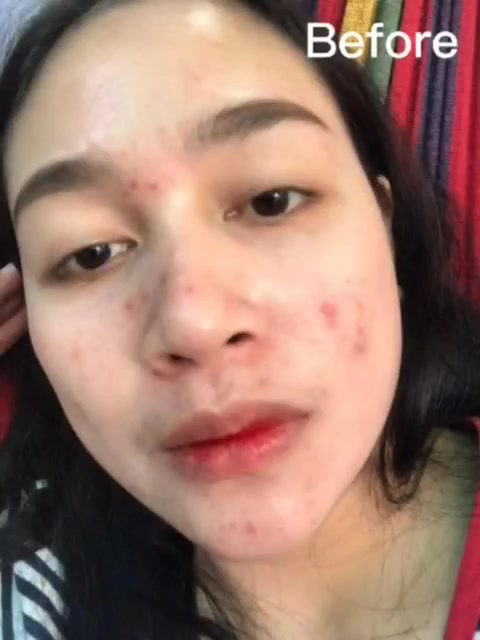 Skin Perfection Official Store, Online Shop | Shopee Philippines