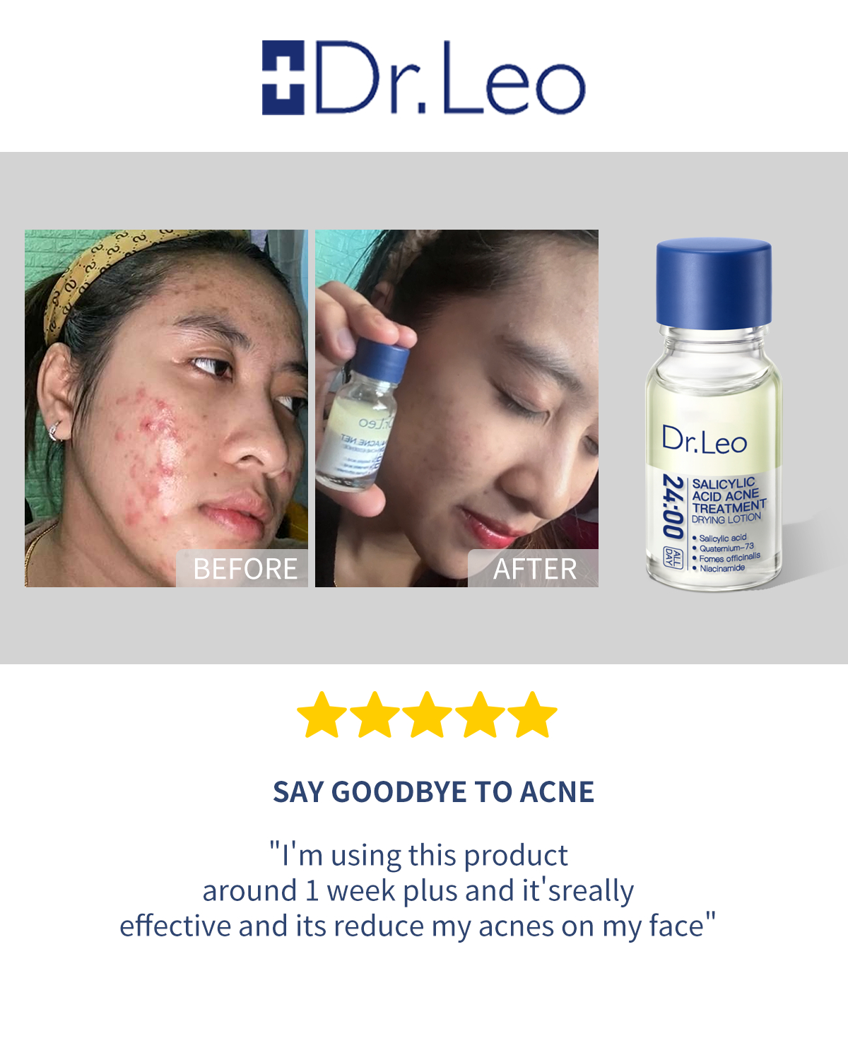 Dr.Leo Store, Online Shop | Shopee Philippines