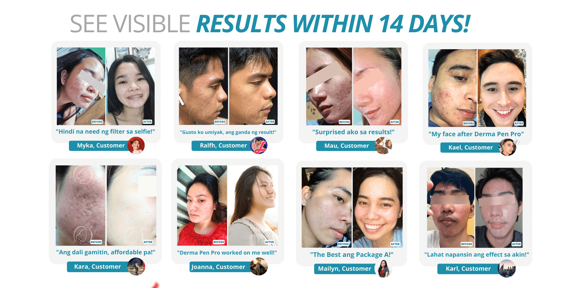 Derma Roller Philippines, Online Shop | Shopee Philippines